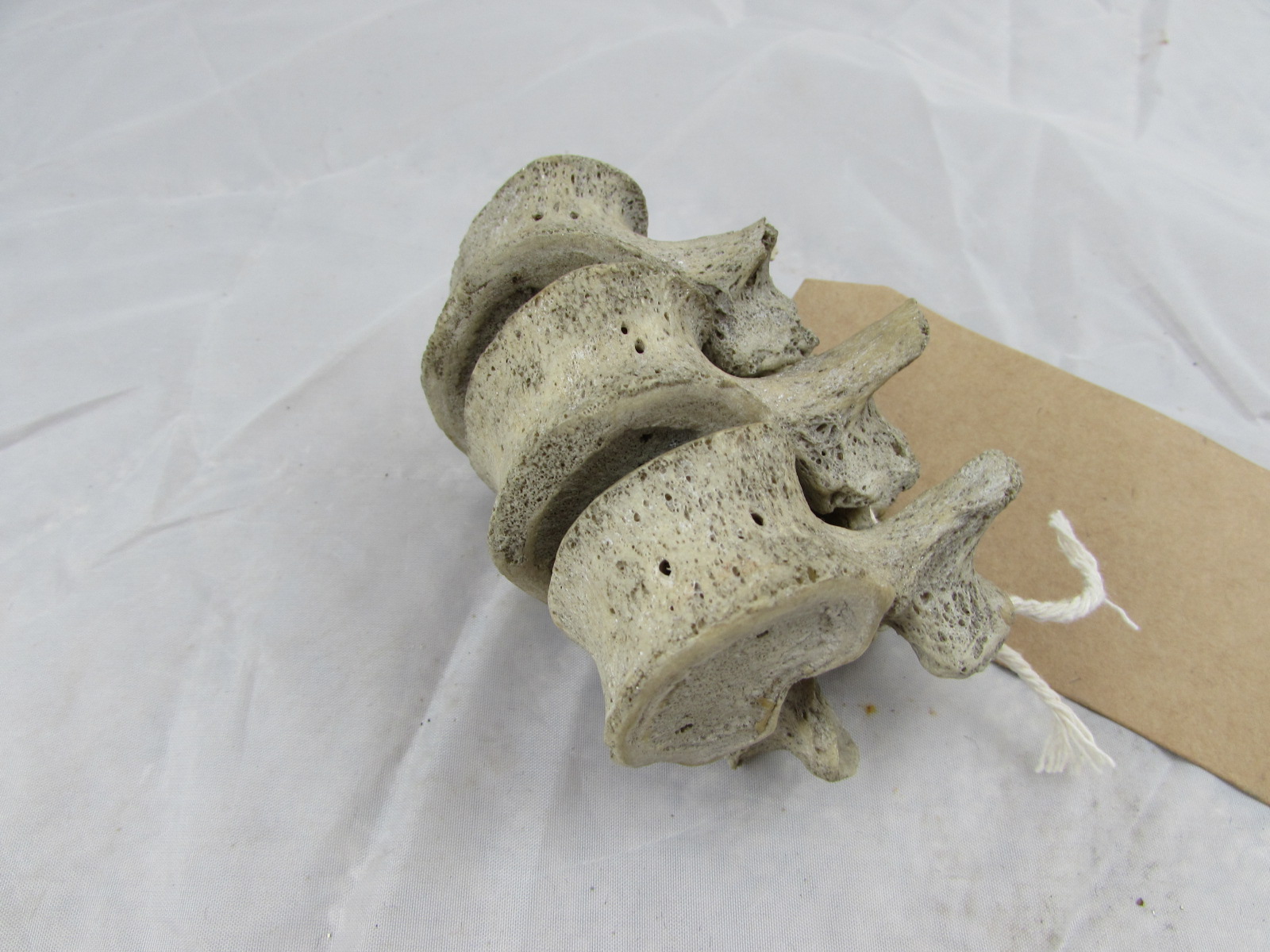 Real Human Vertebra’s “medical specimen” – Legra Antiques